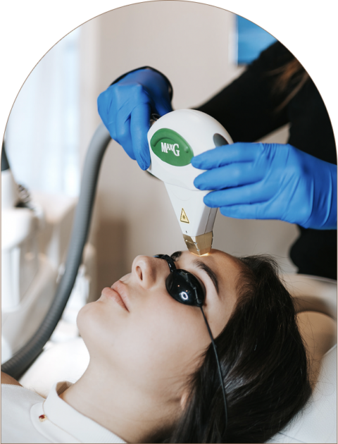 IPL Photofacial | MD Esthetics